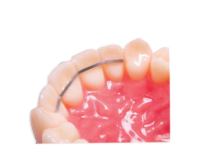 OrthoClassic Dead Soft Retention Wire | Libral Traders